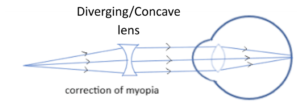 Eye Diagram GCSE Biology | Explained with Examples